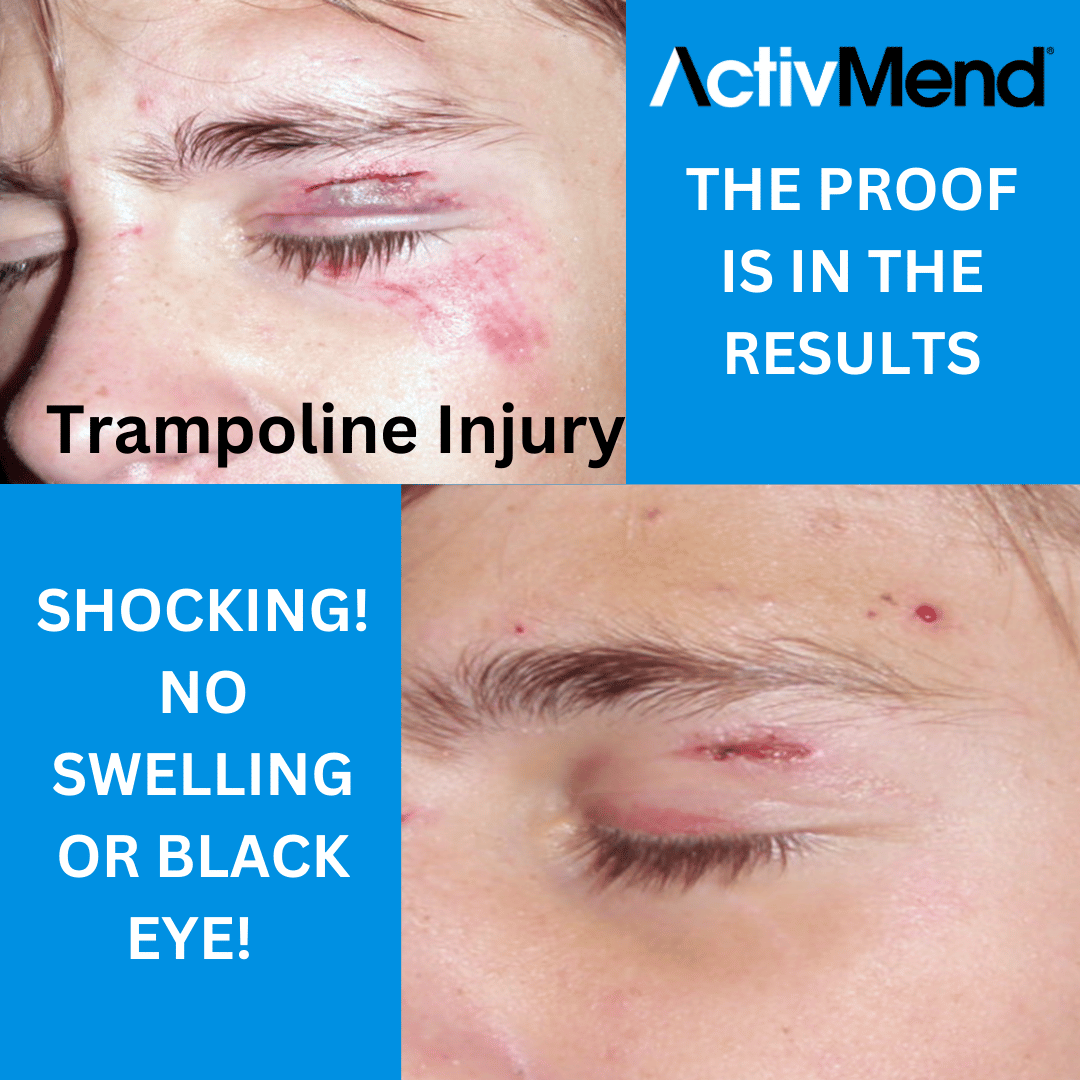 ActivMend - accelerated healing and recovery